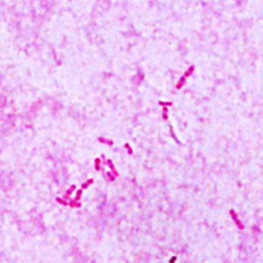 Gram Stain showing Gram negative rods